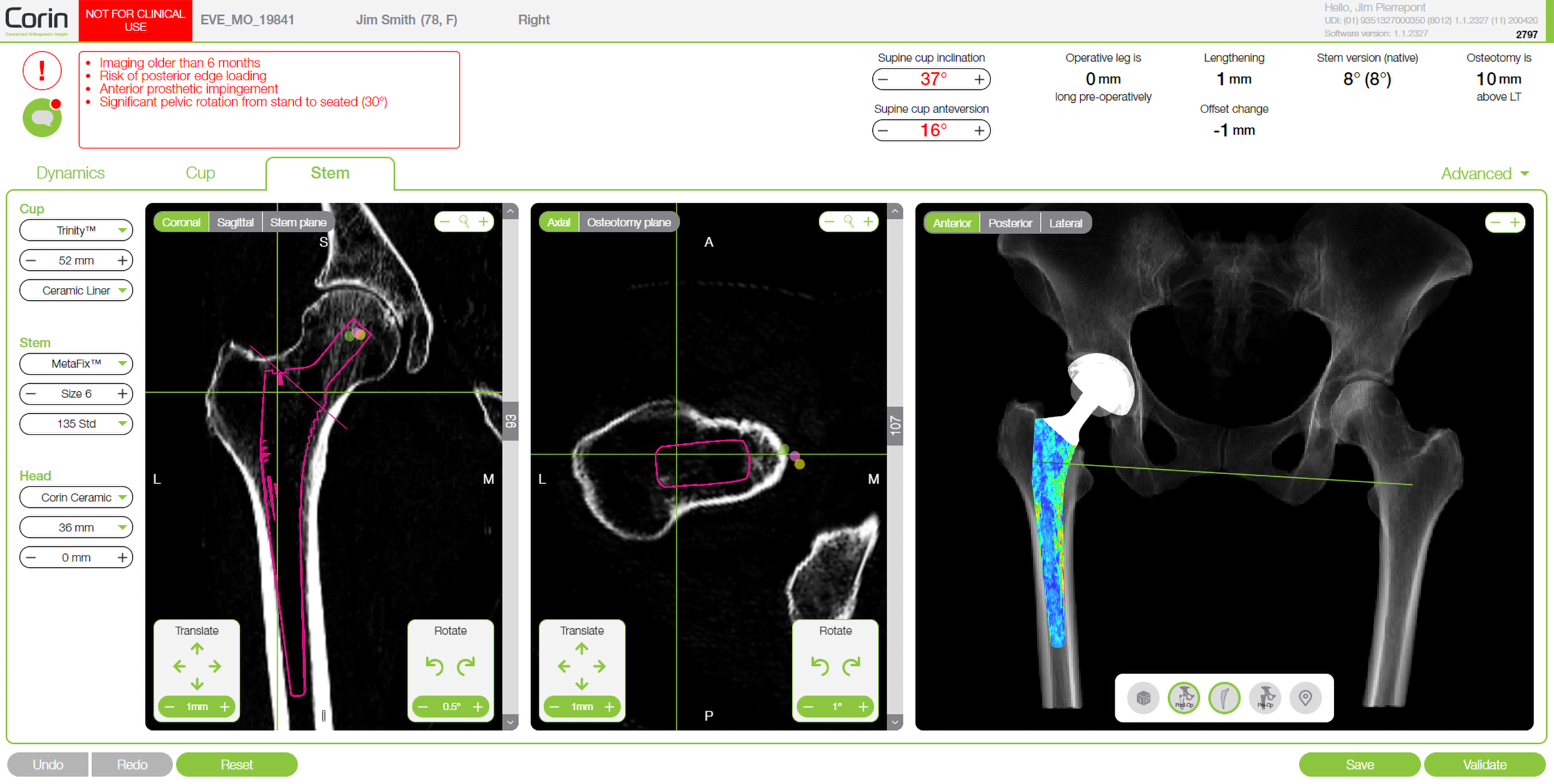 OPSInsight - Good Design