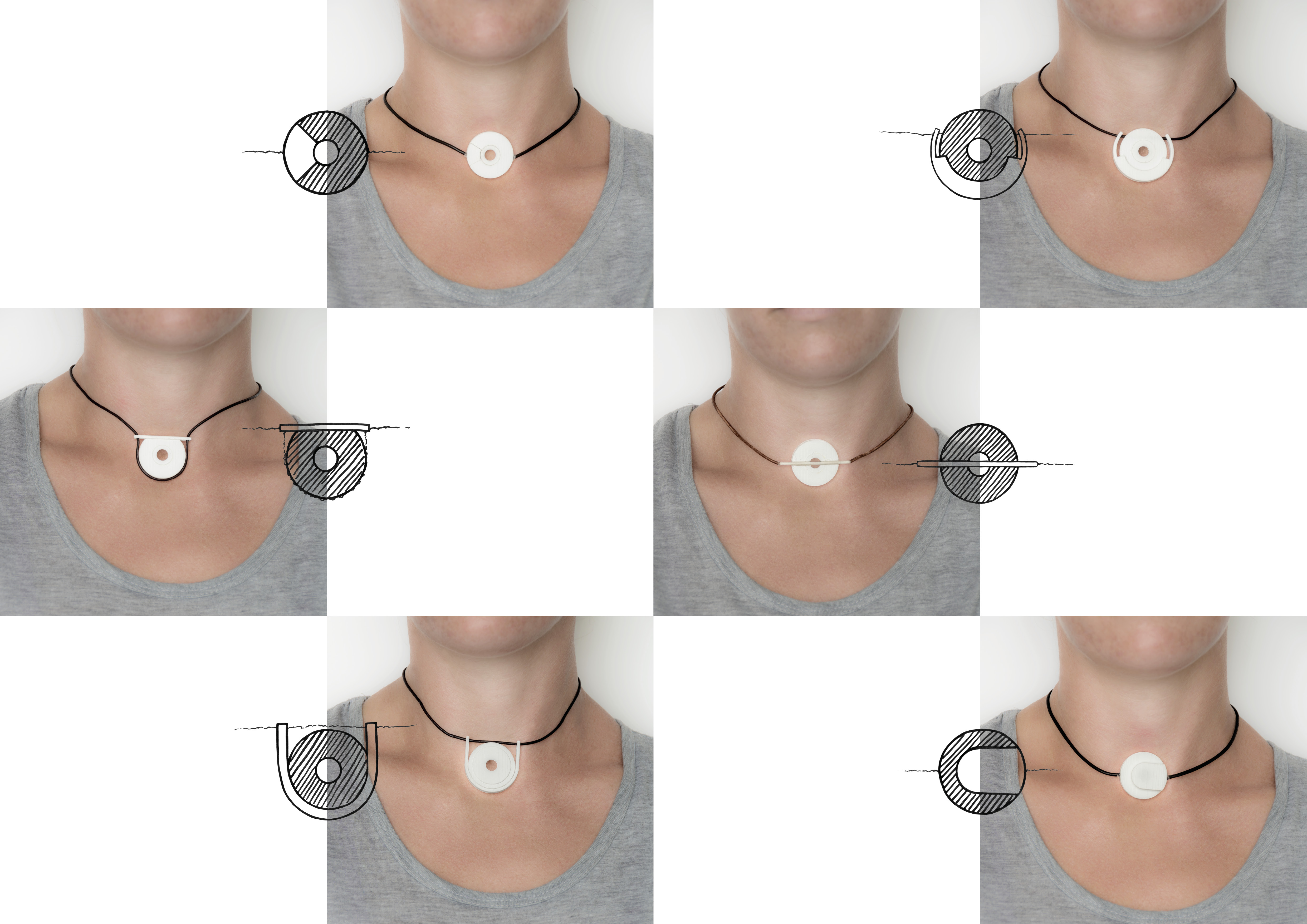 Tracheostomy - From Stigma to Silver Linings - Good Design