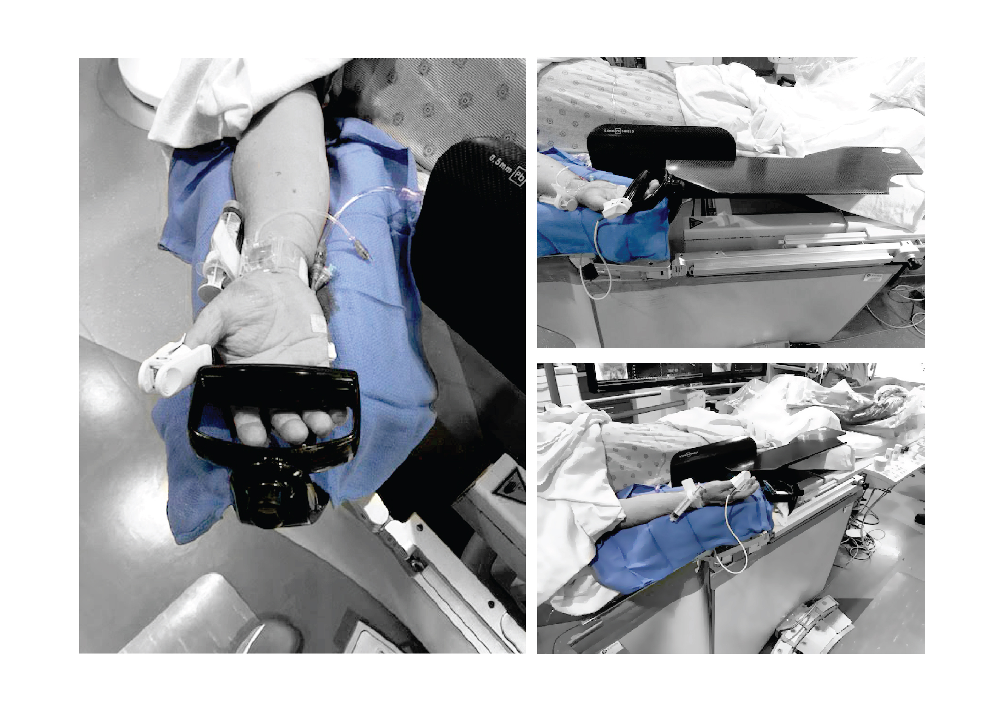 STARSystem- a complete, clinically engineered solution for radial ...